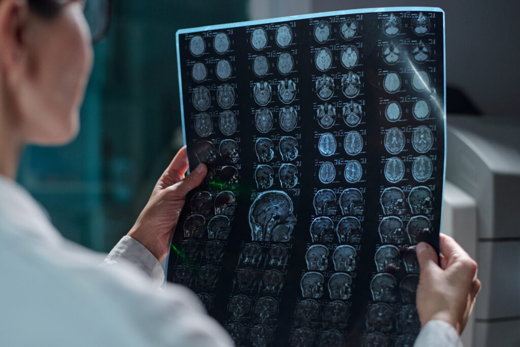 Pioneering Progress in Radiology: How Artificial Intelligence